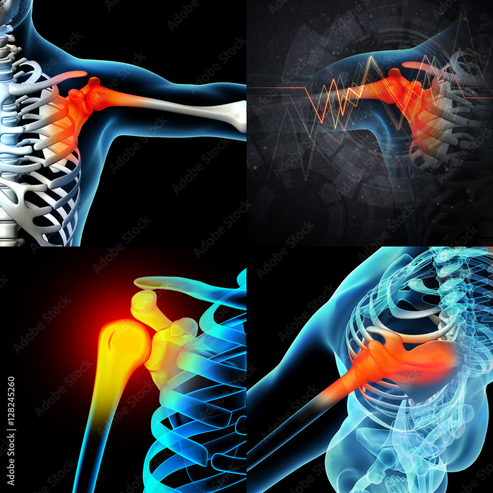 3d render human shoulder pain with the anatomy of a skeleton sho Stock ...