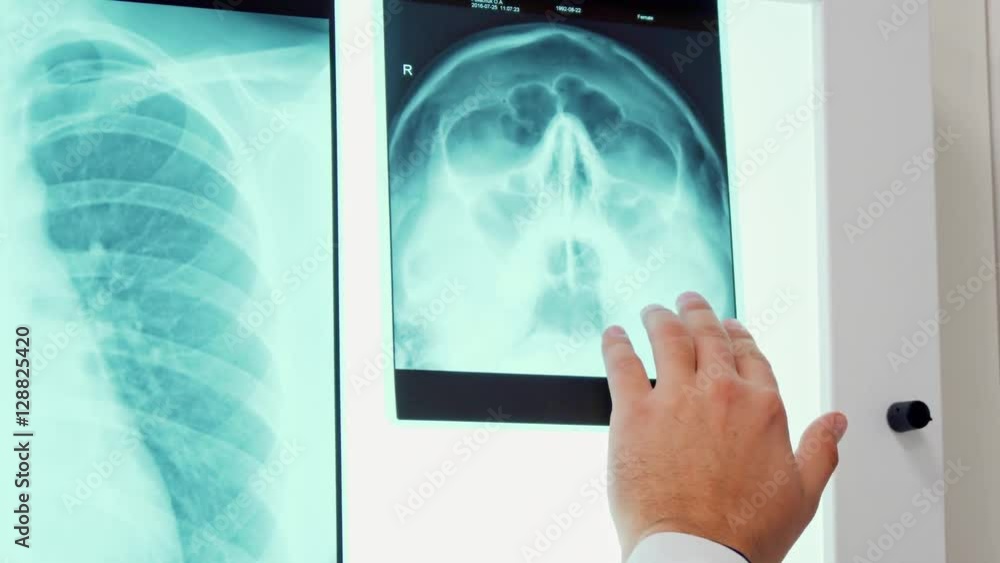 Close up of male hand moving on the x-ray. Male hand touching x-ray ...