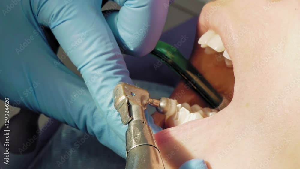 Woman at the dental hygienist and dentist clinic professional tooth ...