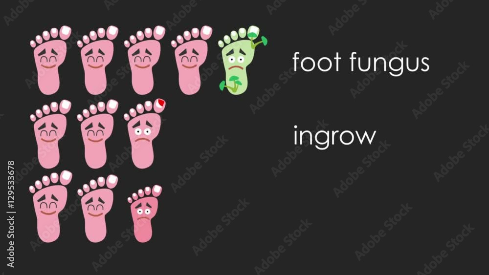 Foot podiatry medical infographic concept. Human feet anatomy ...