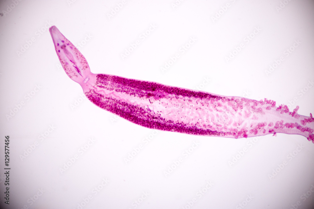 Flukes infestation (parasite) under microscope view. Stock Photo ...