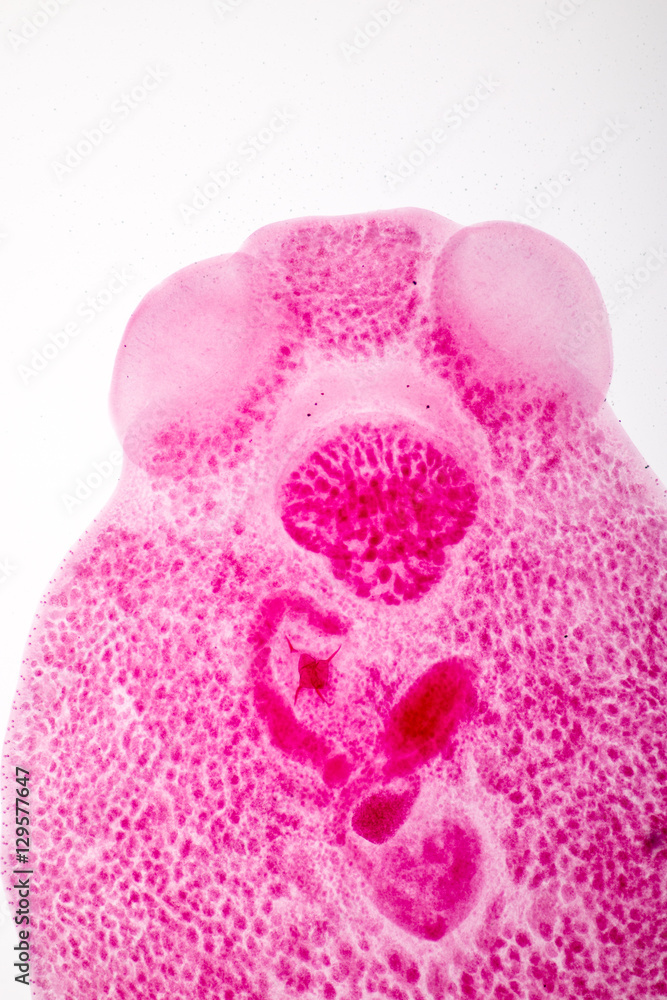 Flukes infestation (parasite) under microscope view. Stock-Foto | Adobe ...