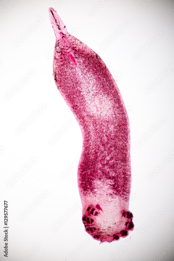 Flukes infestation (parasite) under microscope view. Stock-Foto | Adobe ...