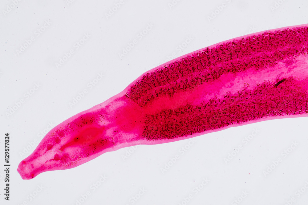 Flukes infestation (parasite) under microscope view. Stock Photo ...