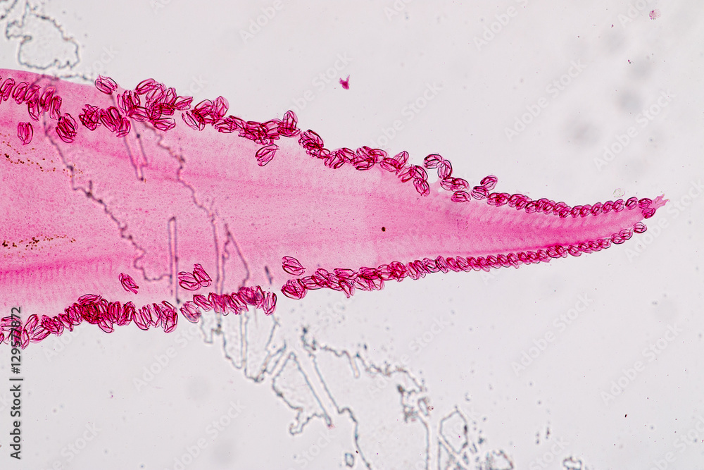 Flukes infestation (parasite) under microscope view. Stock Photo ...