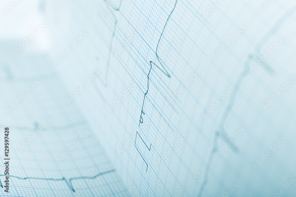 ECG paper record, medical background Stock Photo | Adobe Stock