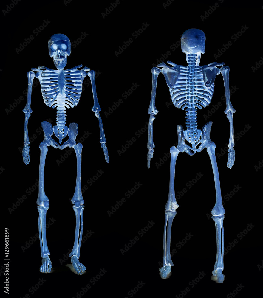 The pattern human skeletons X-Ray on black background ,skeleton pattern ...