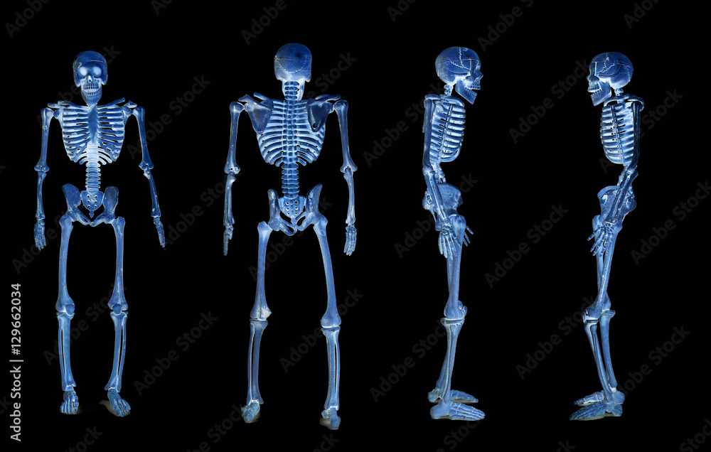 The pattern human skeletons X-Ray on black background ,skeleton pattern ...