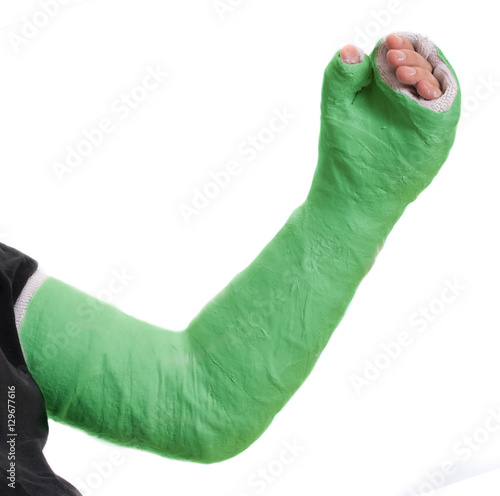 Green Arm Cast