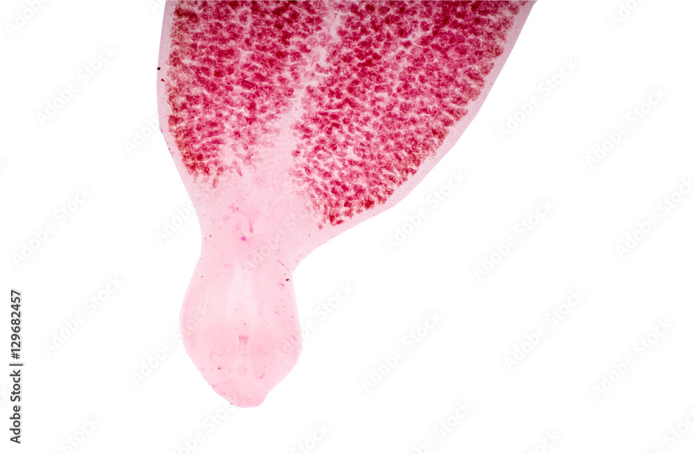 Pricea multae,Monogenea (parasite) under microscope view. foto de Stock ...