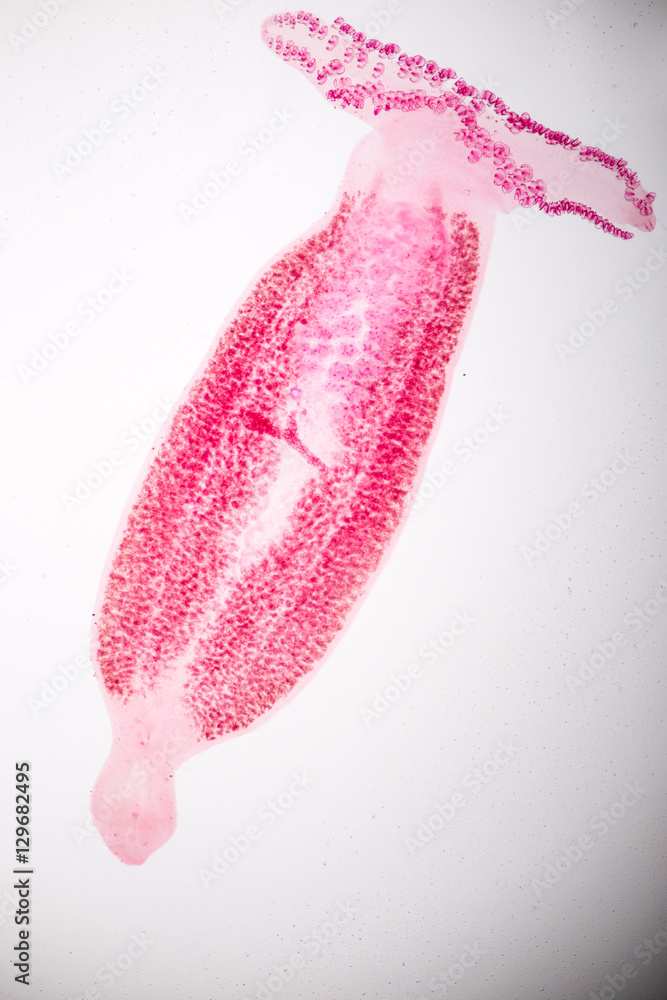 Pricea multae,Monogenea (parasite) under microscope view. Stock Photo ...