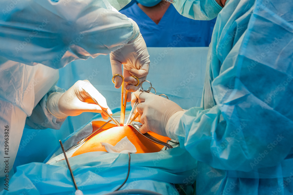Complex laparoscopic operation on a peritoneal cavity is carried out in ...