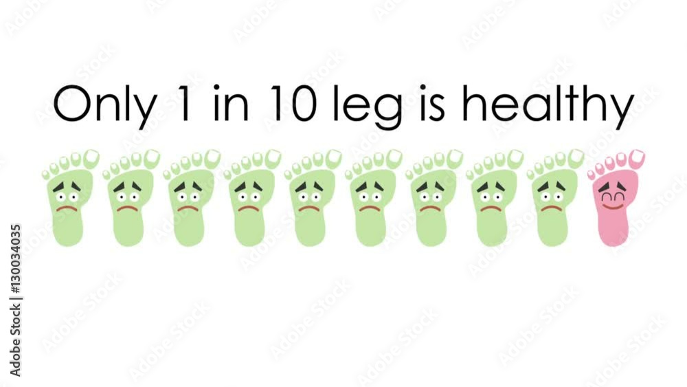 Foot podiatry medical infographic concept. Human feet anatomy. Out of ...