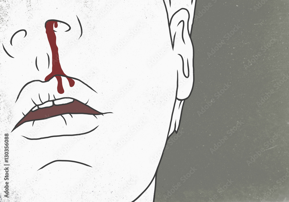 Illustration of man with bleeding nose representing injury Stock-Foto ...