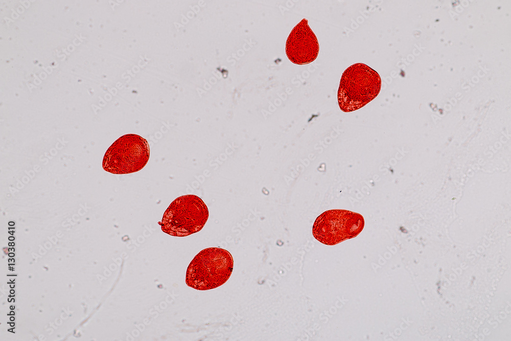 Cycts parasite on slide under the microscope. under microscope view ...