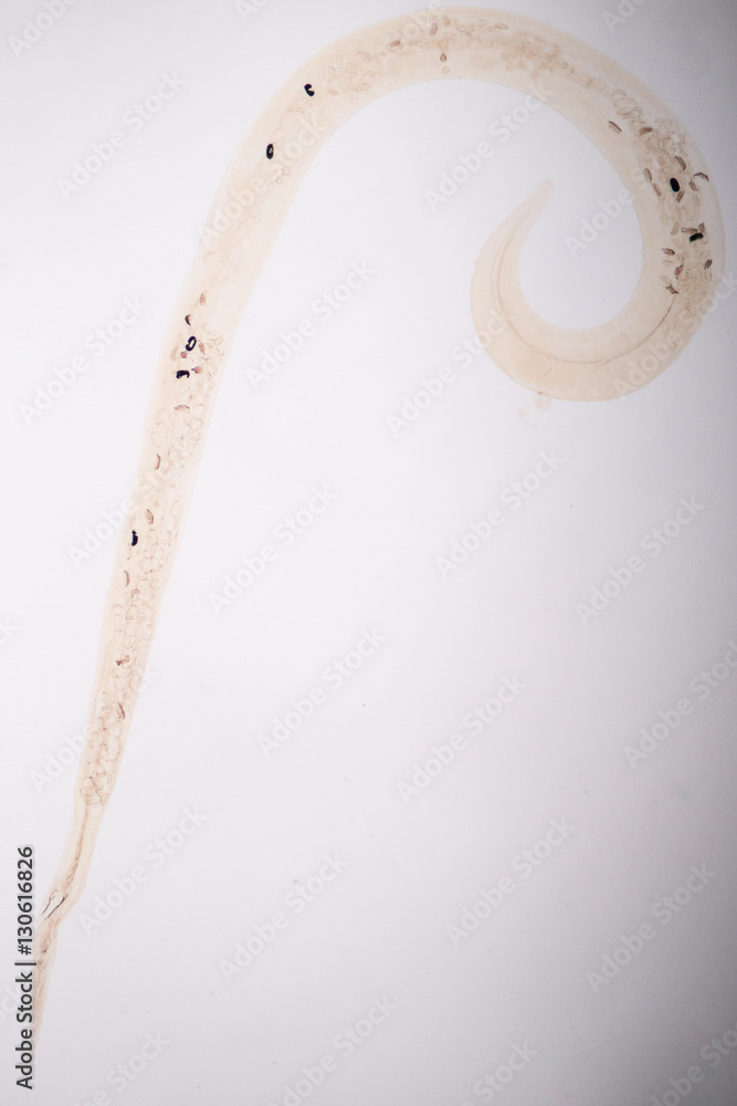 Heterakis gallinarum parasite on slide under microscope view. Stock ...