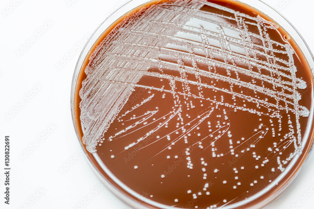 Bacterial colonies culture on Chocolate agar. (CA agar) Stock Photo ...