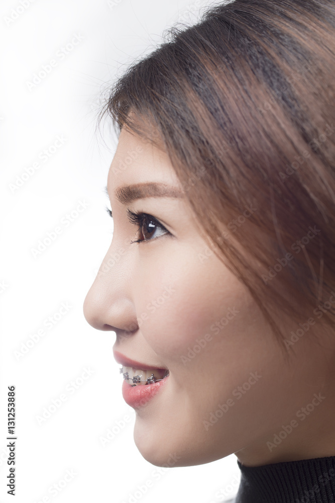 Foto Stock Portrait of a girl with braces | Adobe Stock Foto Stock Portrait of a girl with braces | Adobe Stock