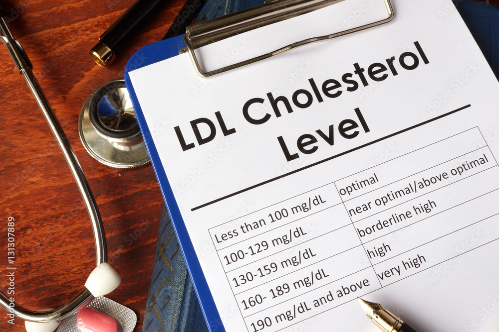Foto Stock LDL (Bad) Cholesterol level chart on a table. | Adobe Stock