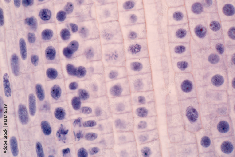 Root tip of Onion and Mitosis cell in the Root tip of Onion under a ...
