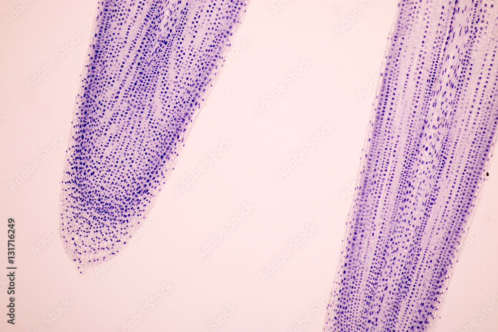 Root tip of Onion and Mitosis cell in the Root tip of Onion under a ...