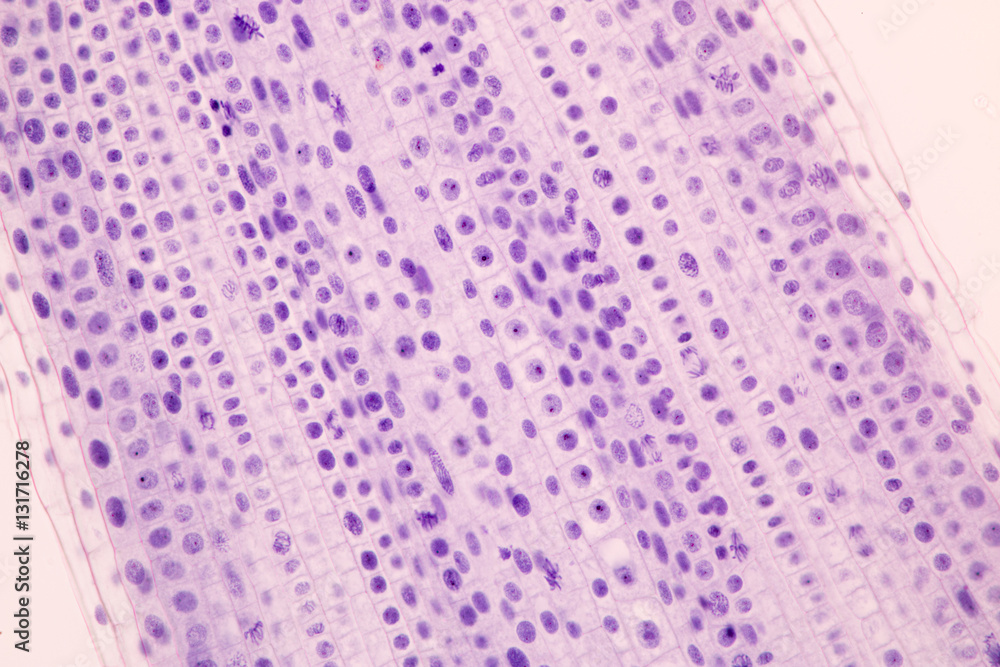 Root tip of Onion and Mitosis cell in the Root tip of Onion under a ...