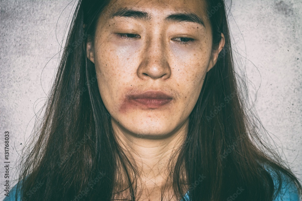 woman being abuse, bruised on face with black shadow Stock Photo ...