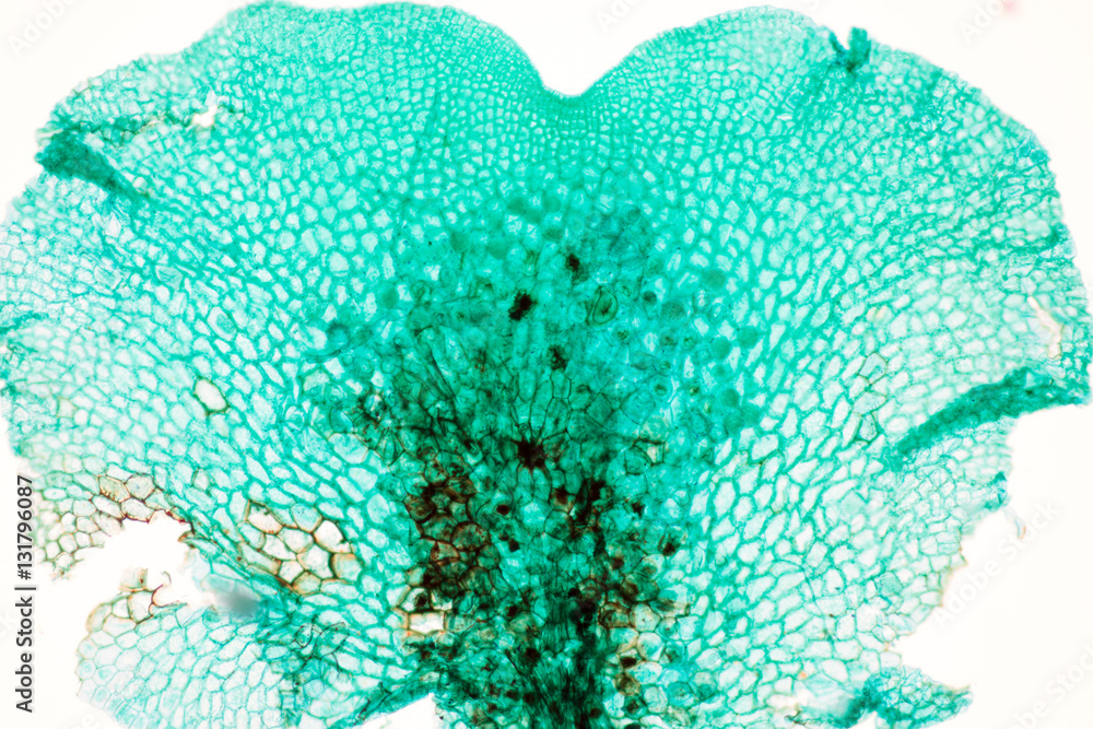 Fern, Archegonia and Antheridia under microscope view. Stock Photo ...