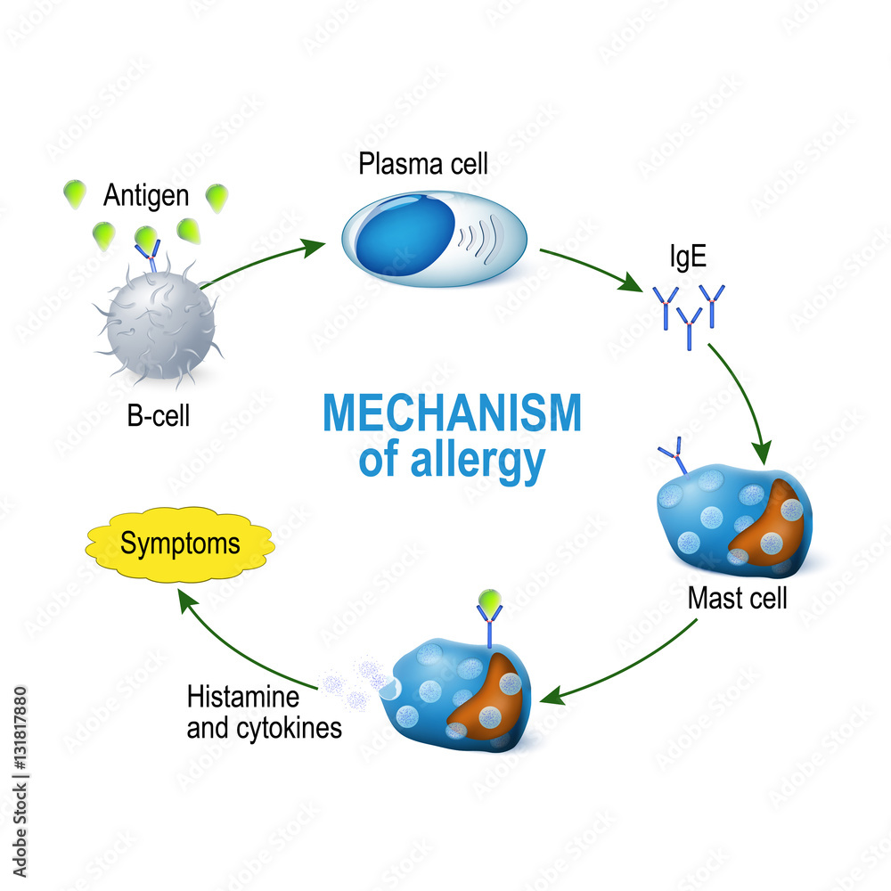 Poster Mechanism of allergy. Mast cells and allergic reaction – Wall Art | UkPosters