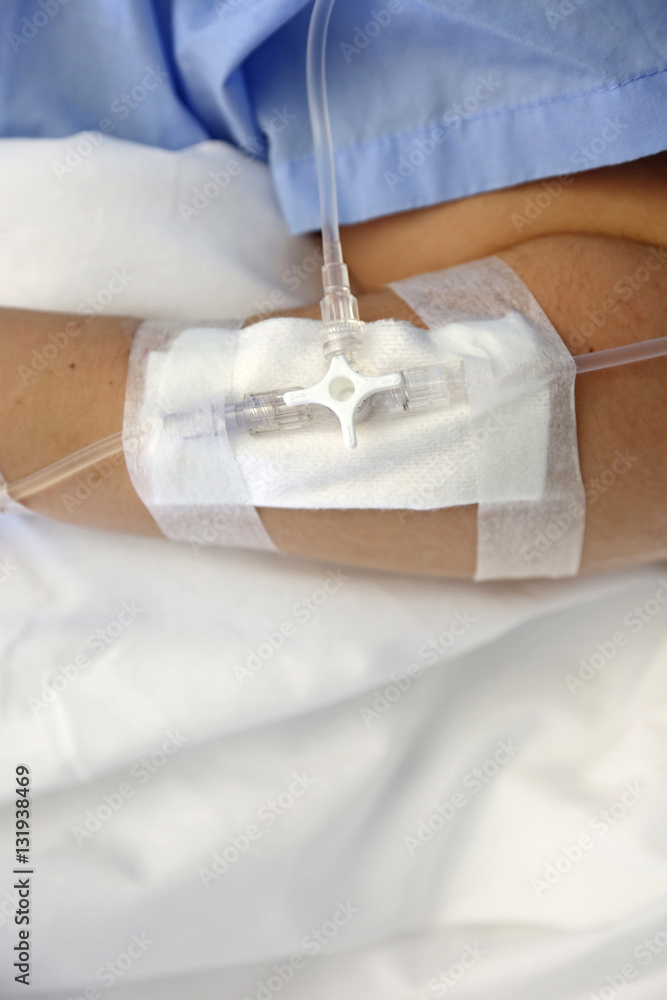 hospital paciente cama brazo con suero U84A1876-f16 Stock Photo | Adobe ... hospital paciente cama brazo con suero U84A1876-f16 Stock Photo | Adobe ...