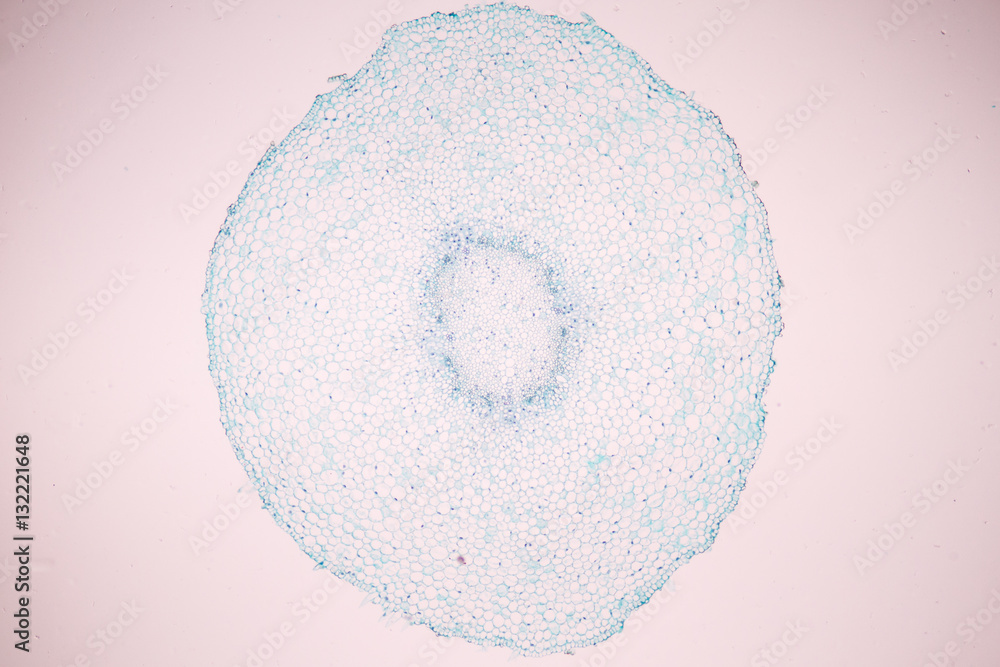 Root and Typical Dicot on the slide under microscope view. Stock Photo ...