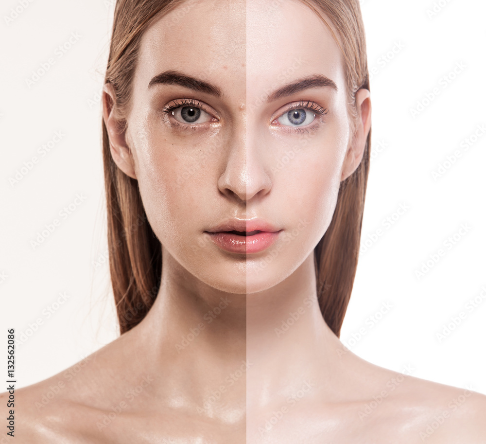 before after close up beauty skin shot Stock Photo | Adobe Stock