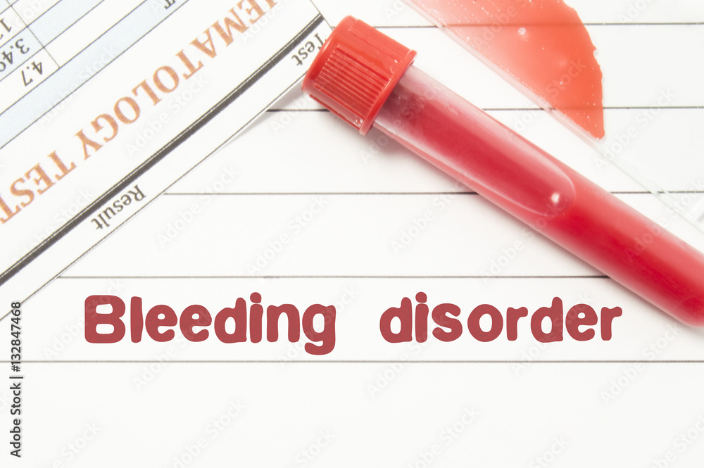 Fotka „Diagnosis Bleeding Disorder. Notepad with text labels Bleeding ...