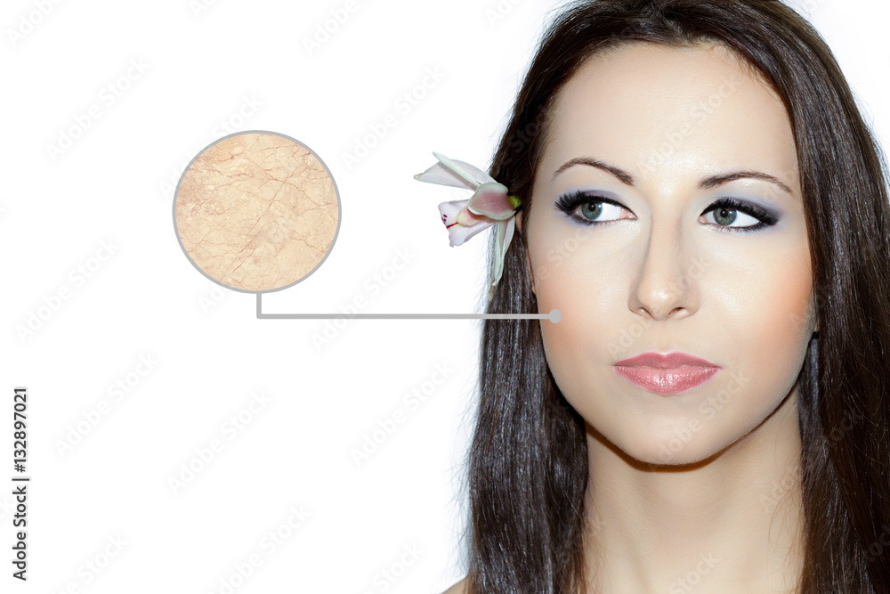 dry skin concept. portrait of a young woman with skin problems isolated ...