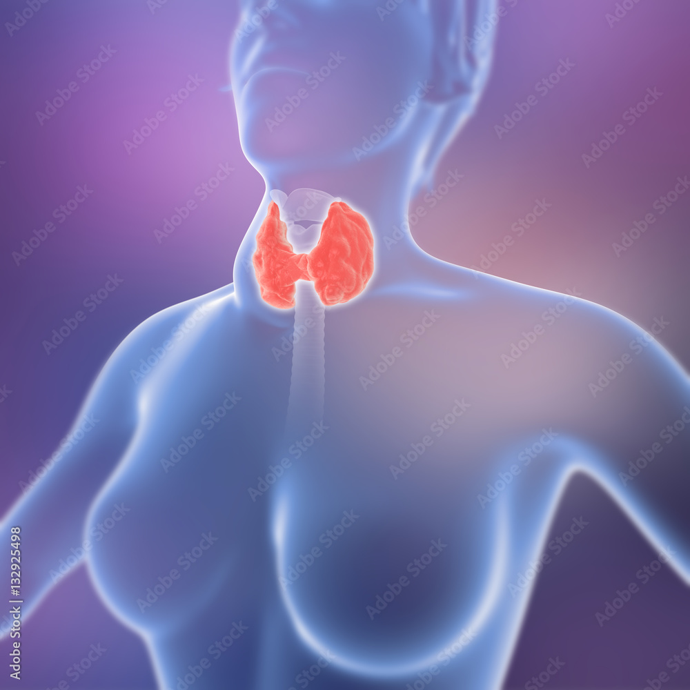 Struma - Schilddrüsenvergrößerung Stock-Illustration | Adobe Stock