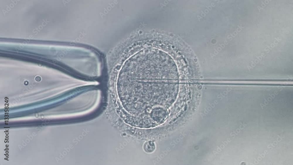 Viewing through microscope on icsi in vitro fertilization procedure ...