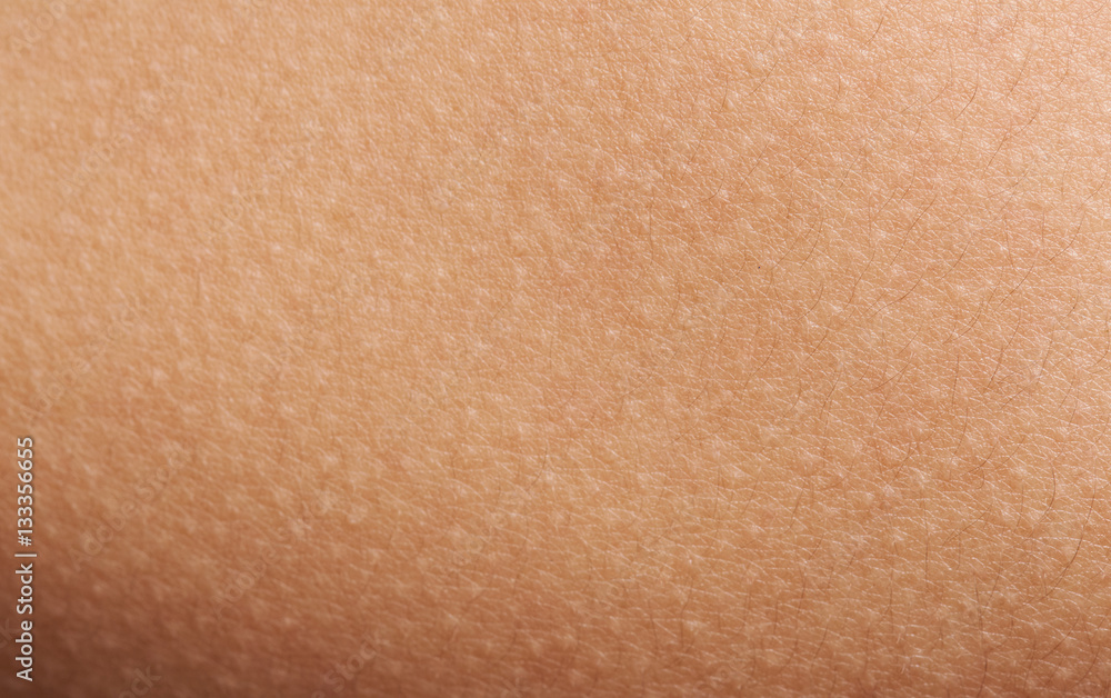 Goose bumps on human skin Stock Photo | Adobe Stock