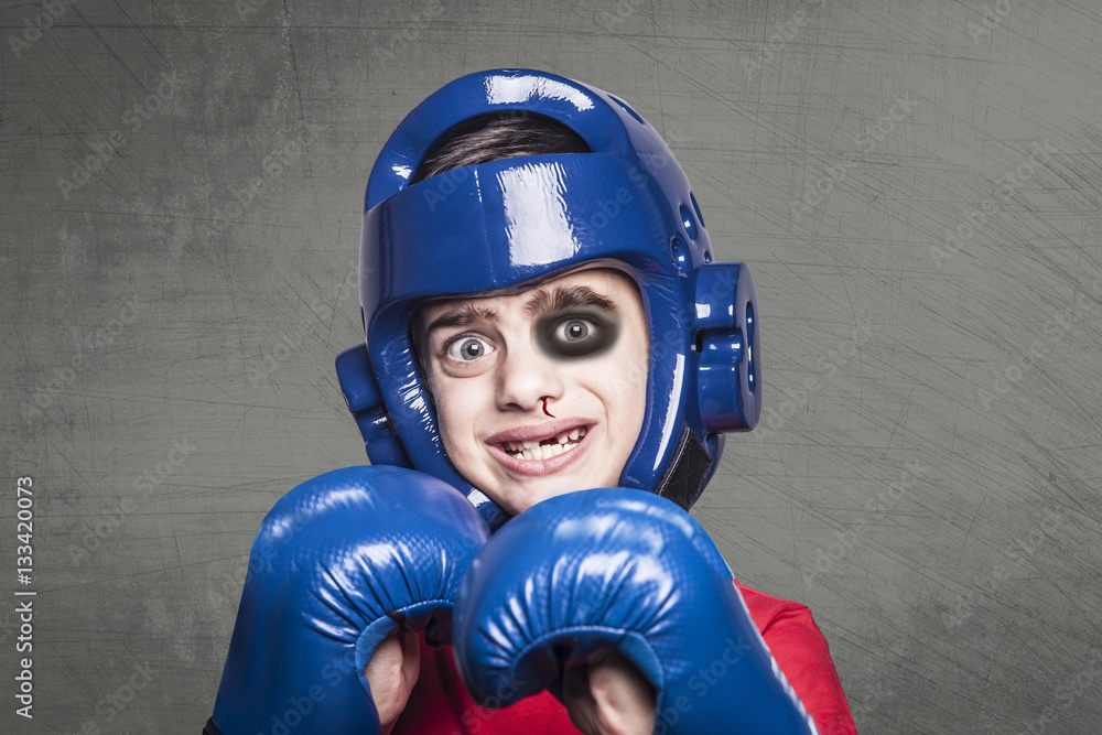 Funny young beaten fighter with black eye, bleeding nose and broken ...