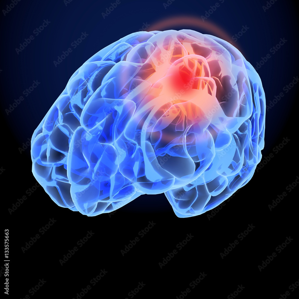 Headache X-Ray 3D model. Brain neurons synapse, anatomy body. Medical ...