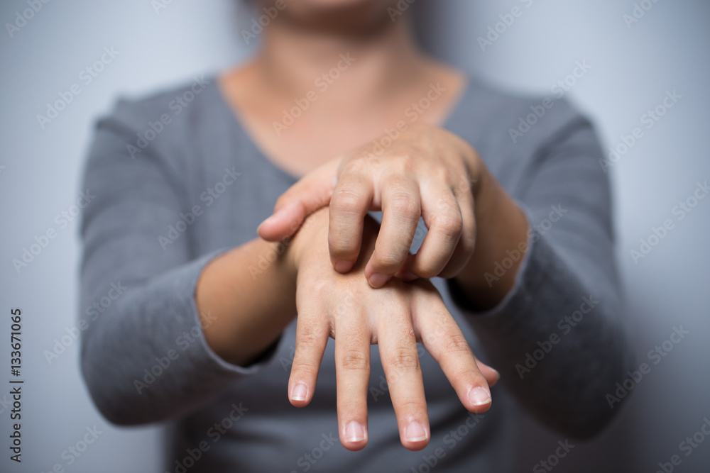 Woman scratching her hand Stock Photo | Adobe Stock
