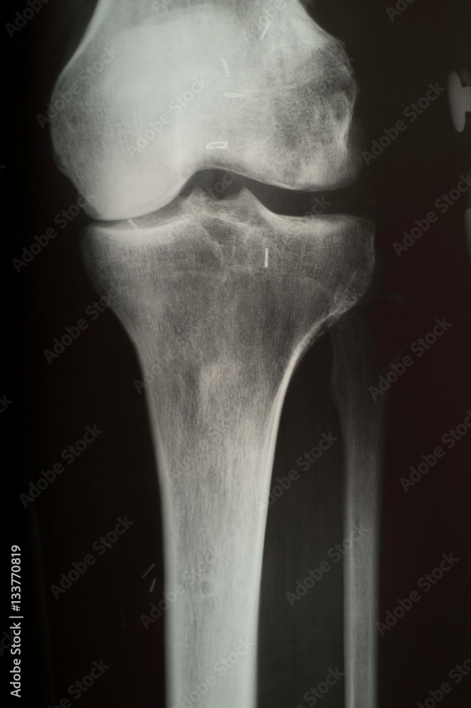 X-ray (model-released) Stock Photo | Adobe Stock