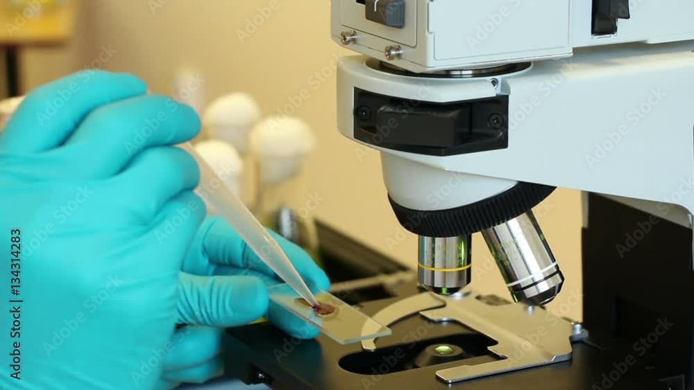 A man touches blood drop on the slide by tip, move it under microscope ...