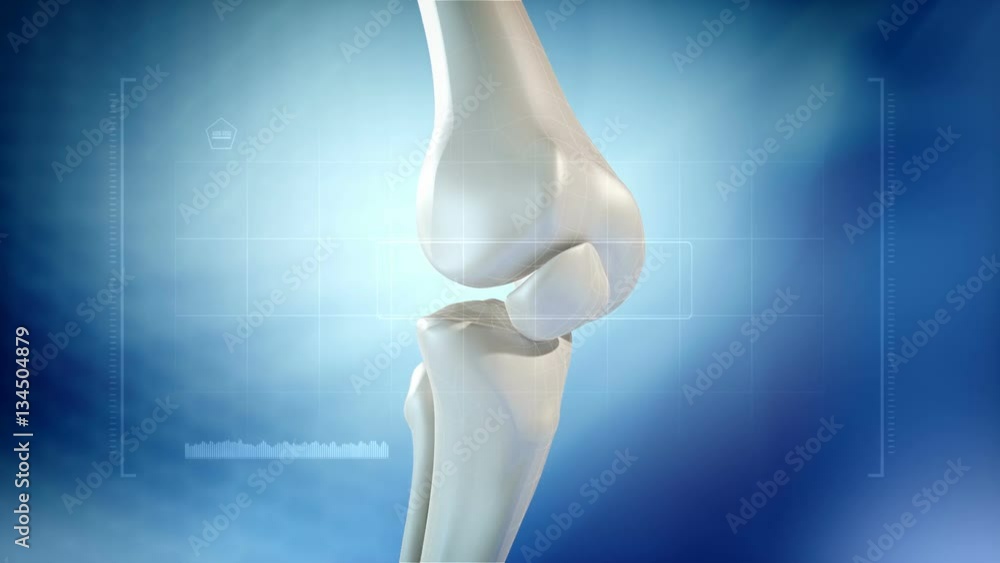 Knee pain animation. Three High Quality animations of Knee pain. Stock ...