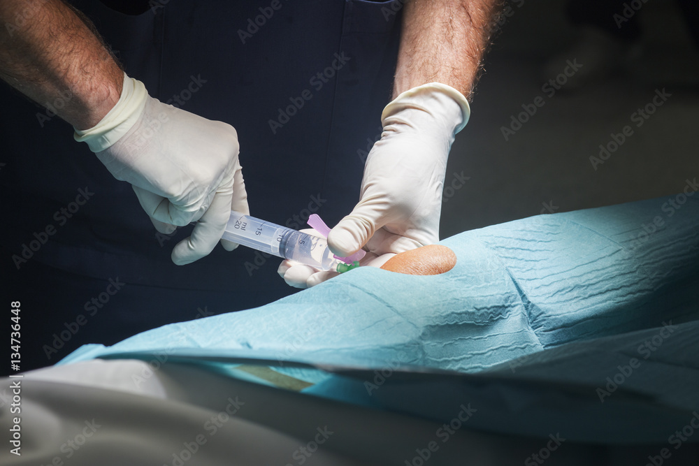 Knee surgery anaesthetic injection Stock Photo | Adobe Stock