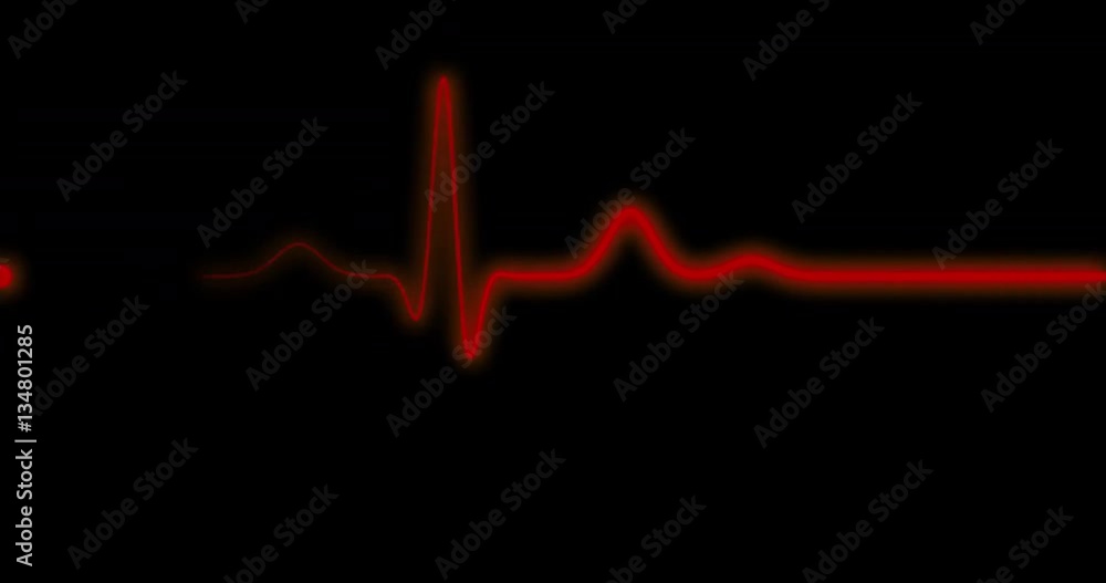 EKG Line / EKG Monitor / EKG Machine / Heart Health. Red ECG monitor ...