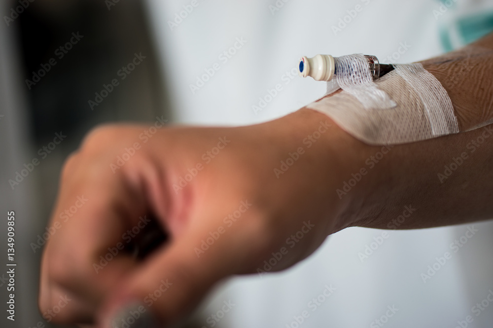 Cannula in right arm of a caucasian female held down by tape as a ...
