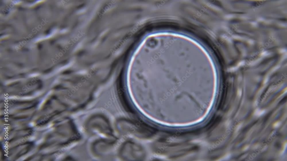 Footage on the theme blood, diseases, interstitial fluid, bacterial ...