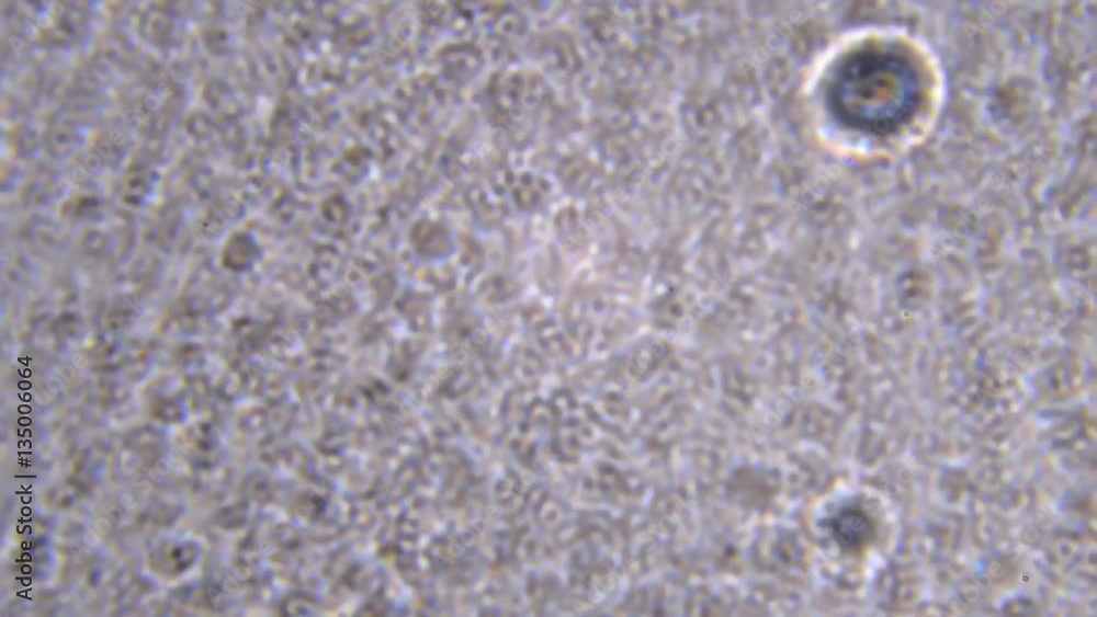 A colony of bacteria under a microscope. Magnification of about 1000x ...