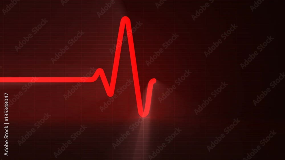 Colorful human heart normal sinus rhythm, electrocardiogram record ...