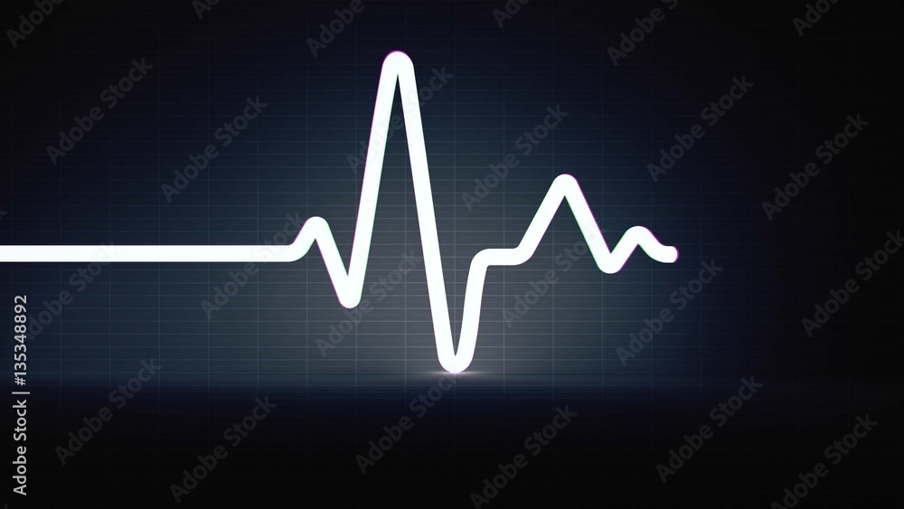 ECG illustration for use in presentations, education manuals, design ...